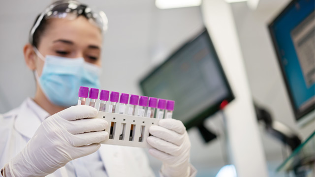 Biosample Management and Data Tracking: Setting Your LIMS Workflow Right